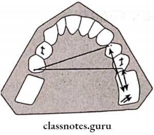 Removable Partial Dentures Long Essays - Class Notes
