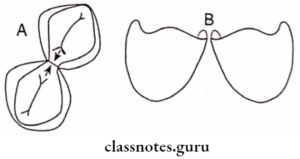 Removable Partial Dentures - Class Notes