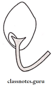 Removable Partial Dentures Long Essays - Class Notes