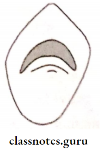 Removable Partial Dentures Long Essays - Class Notes