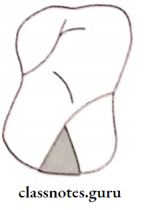 Removable Partial Dentures Long Essays - Class Notes