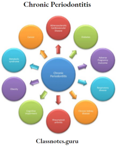Chronic Periodontitis - Class Notes