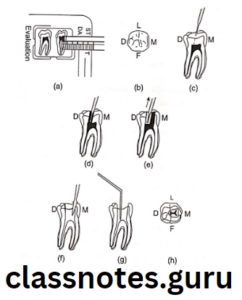 Pulp Space Anatomy And Access Cavities Question And Answers - Class Notes