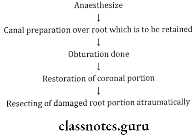 Endodontics Archives - Class Notes