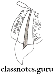 Surgical Endodontics Question And Answers - Class Notes