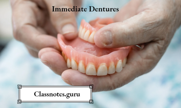 Immediate Dentures - Class Notes