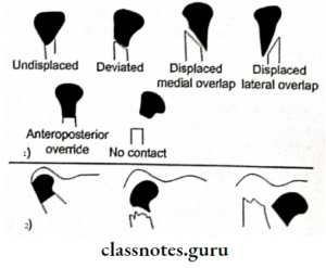 Maxilofacial Surgery Archives - Class Notes