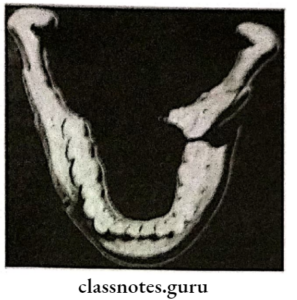Maxilofacial Surgery Archives - Class Notes