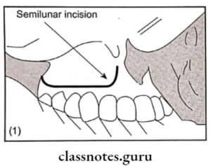 Maxilofacial Surgery Archives - Class Notes