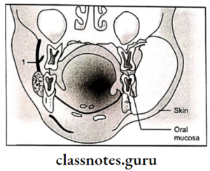Maxilofacial Surgery Archives - Class Notes