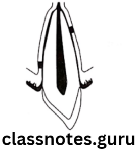 Biology Of Tooth Movement Question And Answers - Class Notes