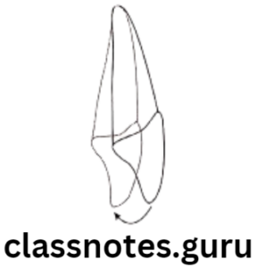 Classification Of Malocclusion Question And Answers - Class Notes