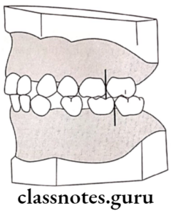 Development Of Dentition And Occlusion Question And Answers - Class Notes