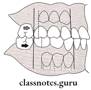 Development Of Dentition And Occlusion Question And Answers - Class Notes
