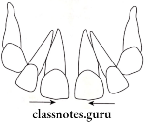 Development Of Dentition And Occlusion Question And Answers - Class Notes