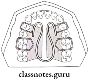 Expansion In Orthodontics Question And Answers - Class Notes