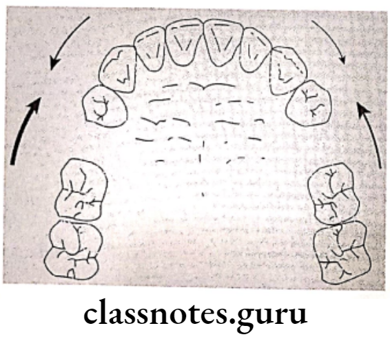 Methods Of Gaining Space in Orthodontics Question And Answers - Class Notes