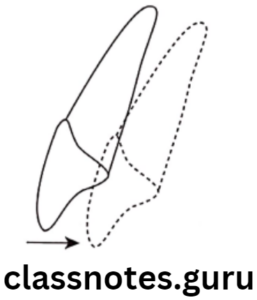 Orthodontic Tooth Movement Question And Answers - Class Notes