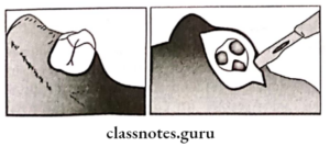 Pre Prosthetic Surgery - Class Notes