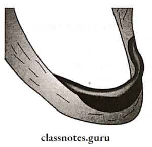Pre Prosthetic Surgery - Class Notes