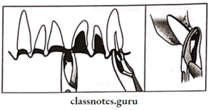 Pre Prosthetic Surgery - Class Notes