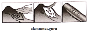 Pre Prosthetic Surgery - Class Notes