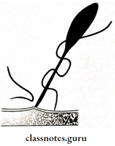 Maxilofacial Surgery Archives - Class Notes