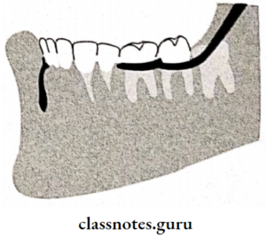Maxilofacial Surgery Archives - Class Notes