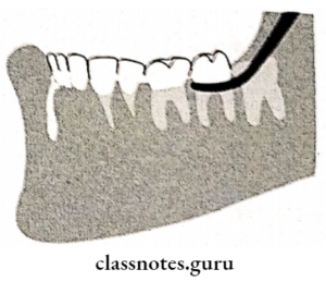Maxilofacial Surgery Archives - Class Notes