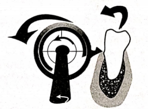 Maxilofacial Surgery Archives - Class Notes