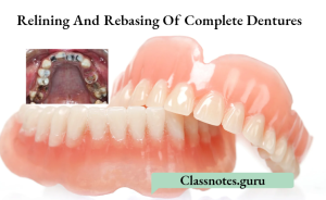 Relining And Rebasing Of Complete Dentures - Class Notes
