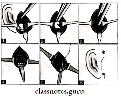 temporomandibular joint disorders Question And Answers - Class Notes
