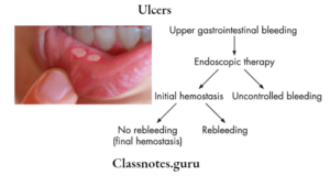 Ulcers Question And Answers - Class Notes
