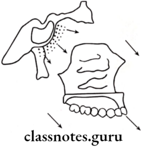 Cleft Lip And Palate Orthodontics Question And Answers - Class Notes