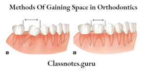 Methods Of Gaining Space In Orthodontics Question And Answers - Class Notes
