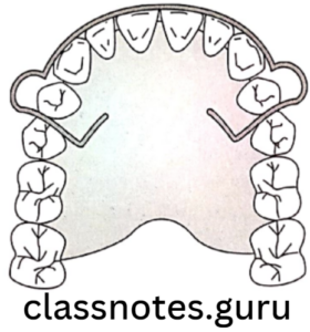 Removable Orthodontic Appliance Question And Answers - Class Notes
