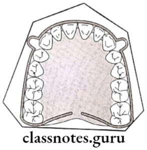 Retention And Relapse In Orthodontics Question And Answers - Class Notes