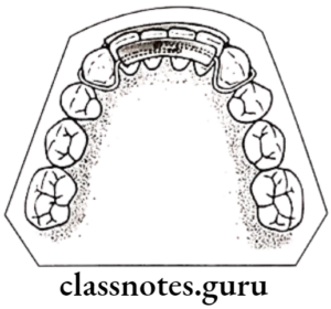 Retention And Relapse In Orthodontics Question And Answers - Class Notes