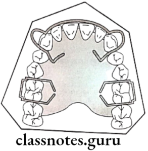 Retention And Relapse In Orthodontics Question And Answers - Class Notes