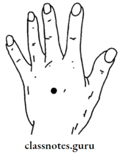 Different Health Issues Occurs In Women Symptoms And Treatment - Class ...