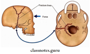 Norma Basalis Of Skull Notes - Class Notes