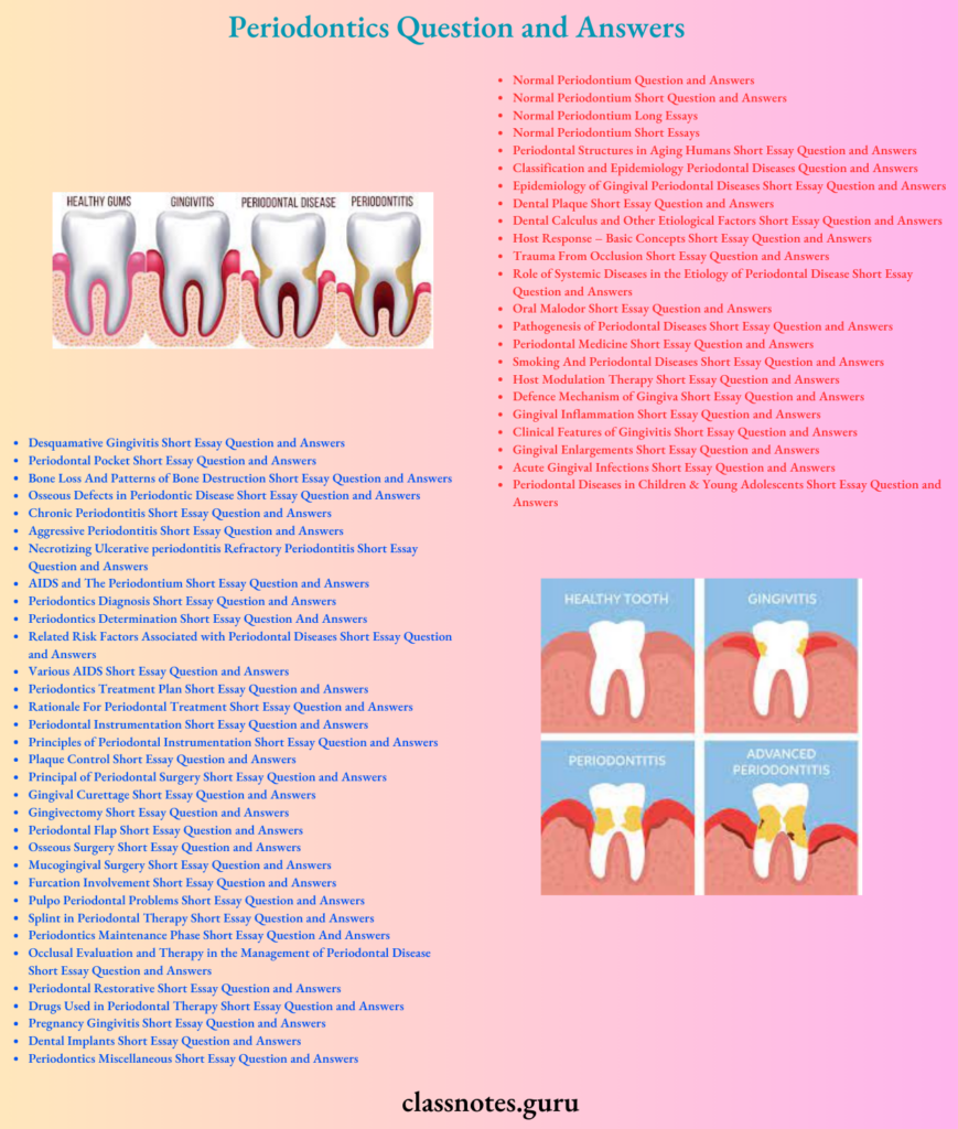 Periodontics Question and Answers - Class Notes