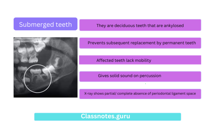 Developmental Disorders Notes - Class Notes