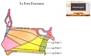 Vomer: Anatomy, Location, And Function Notes - Class Notes