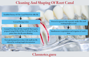 Cleaning And Shaping Of Root Canal Question And Answers - Class Notes