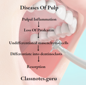 Diseases Of Pulp Question And Answers - Class Notes